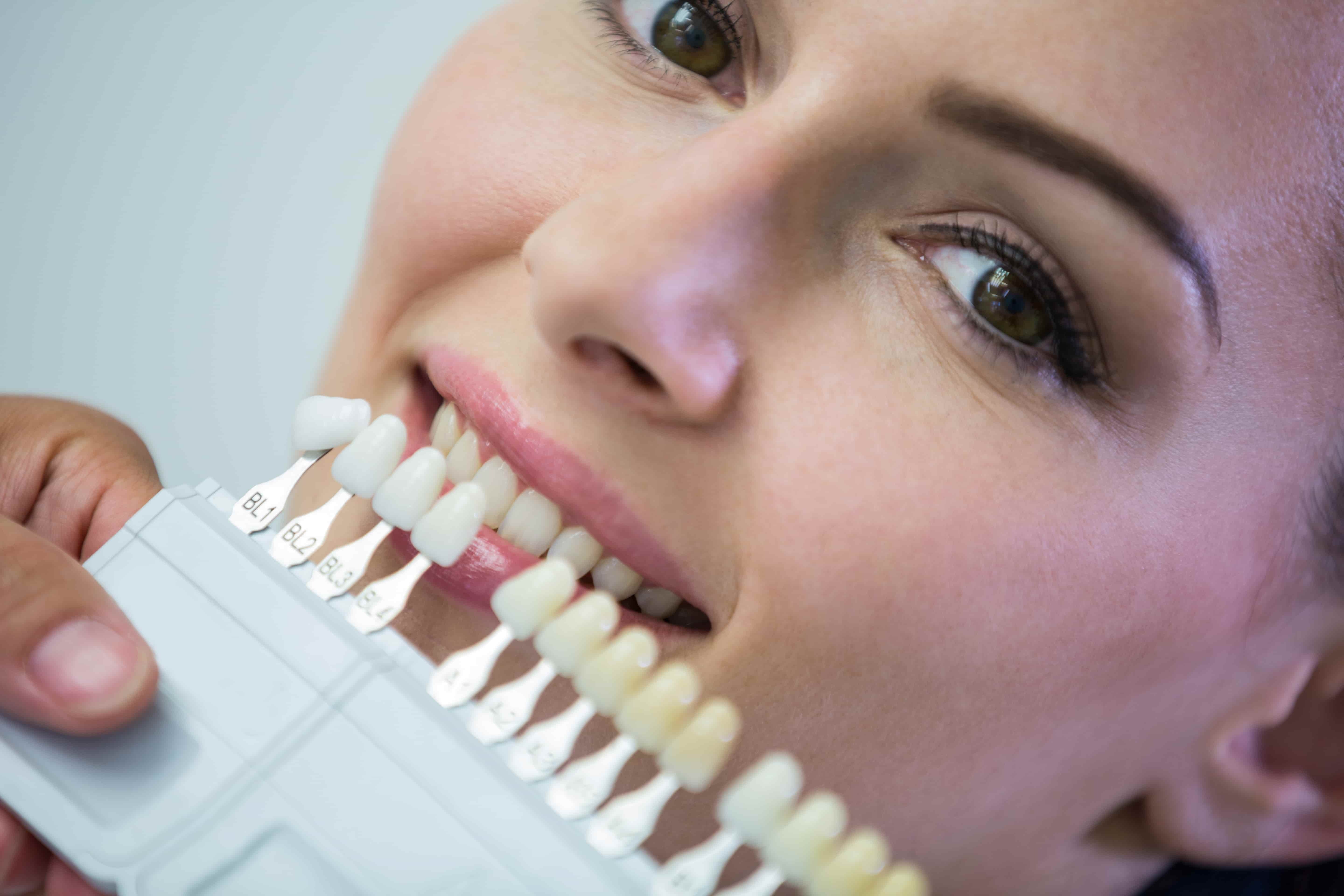 Dental Veneers Cost Australia | Porcelain vs Composite Pricing